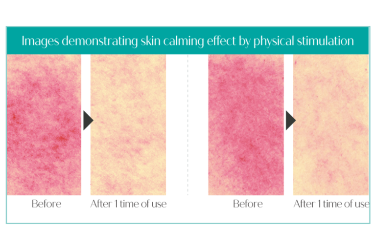 EP+DERM PLUS Post-Procedure Gel & Mask - RIBESKIN Skin Recovery